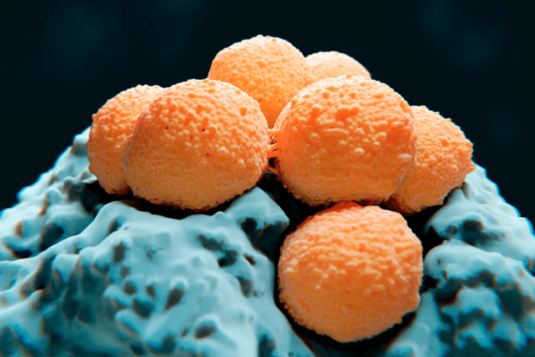 Invasive Group A Strep Infections Have More than Doubled in the United ... Invasive Group A Strep Infections Have More than Doubled in the United ...